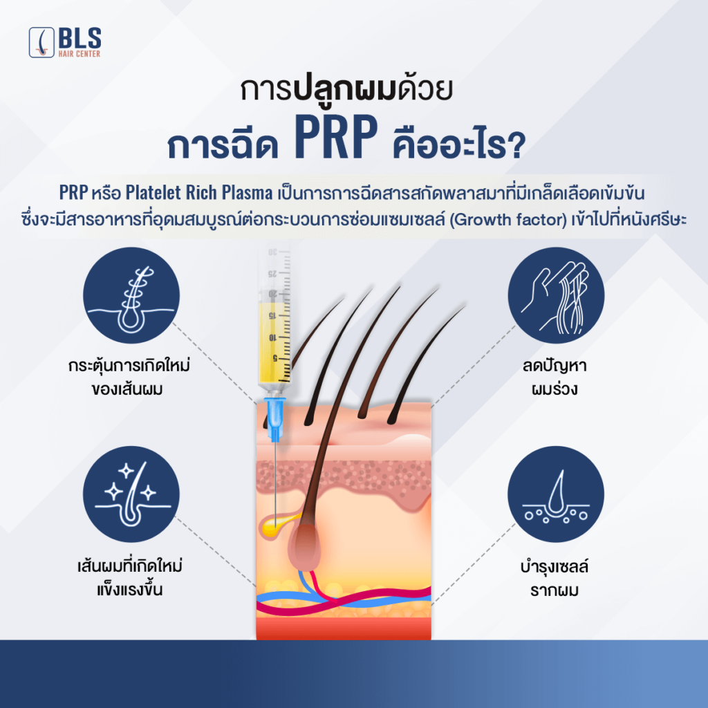 Anti-Hair Loss program for hair loss control